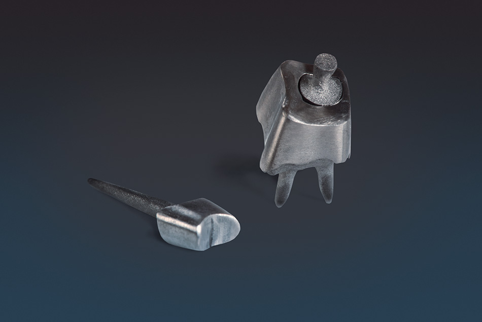 Prothèses fixes - Laboratoire Dentaire Laval Lafond Desjardins