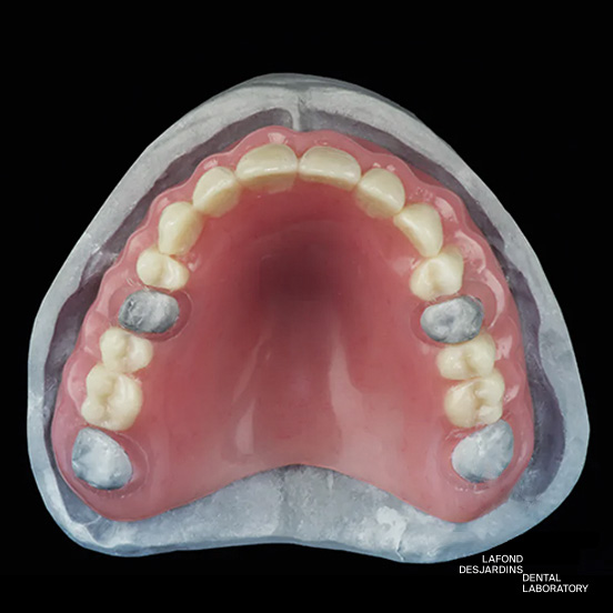 Our work - Laboratoire Dentaire Laval Lafond Desjardins