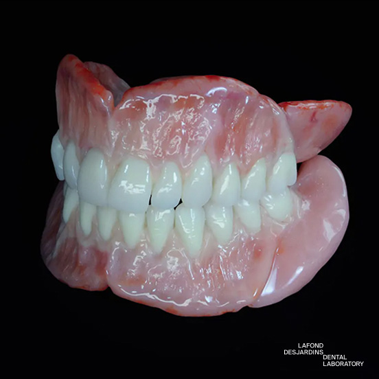 Our work - Laboratoire Dentaire Laval Lafond Desjardins