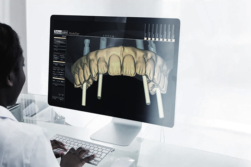 SPECIALIZED CAD CAM SOFTWARE - Laboratoire Dentaire Laval Lafond Desjardins